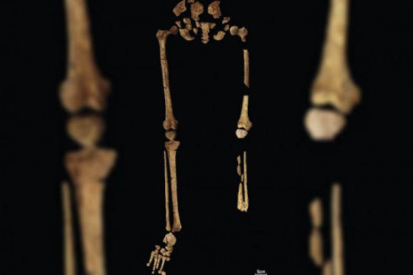 Pasien Amputasi Ribuan Tahun Lalu Kerangkanya Ditemukan di Kalimantan ...