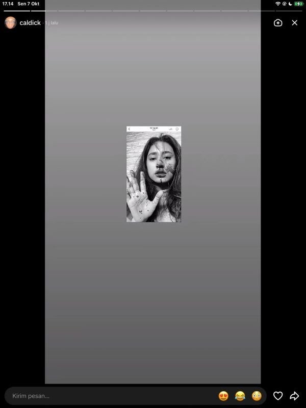 Selebgram Afifah Riyad Diduga Alami KDRT oleh Derry, Foto Wajah Penuh ...